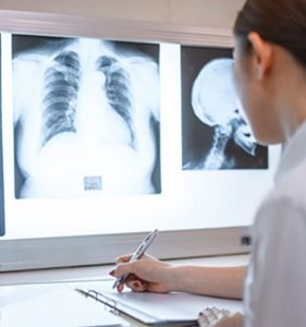What Are X-Rays – Icare Diagnostic Imaging